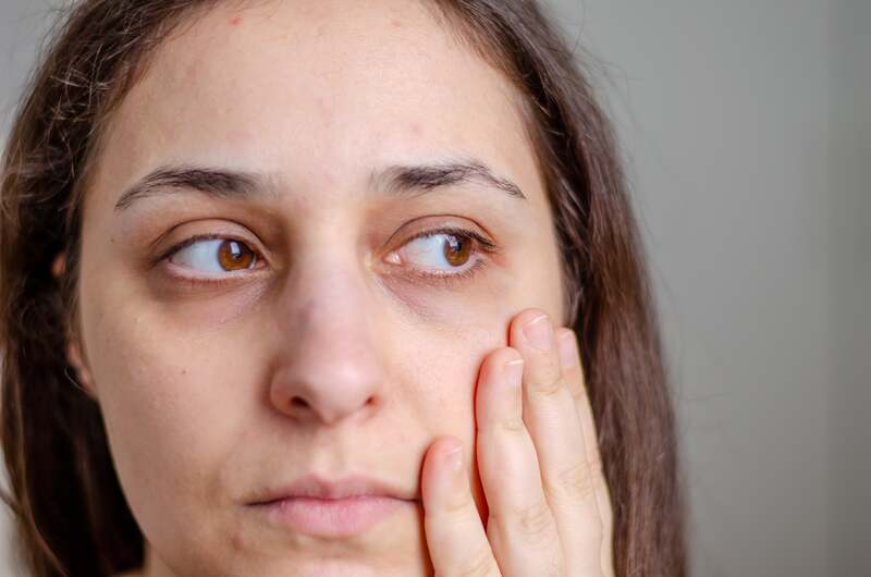 Cernes : simple fatigue ou réel problème de santé