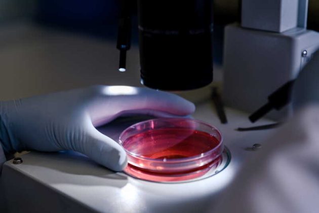 Cancer colorectal : pourquoi ces polypes deviennent-ils cancéreux ...